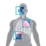 AI Technology Clinical Trial Imaging CRO | Voiant